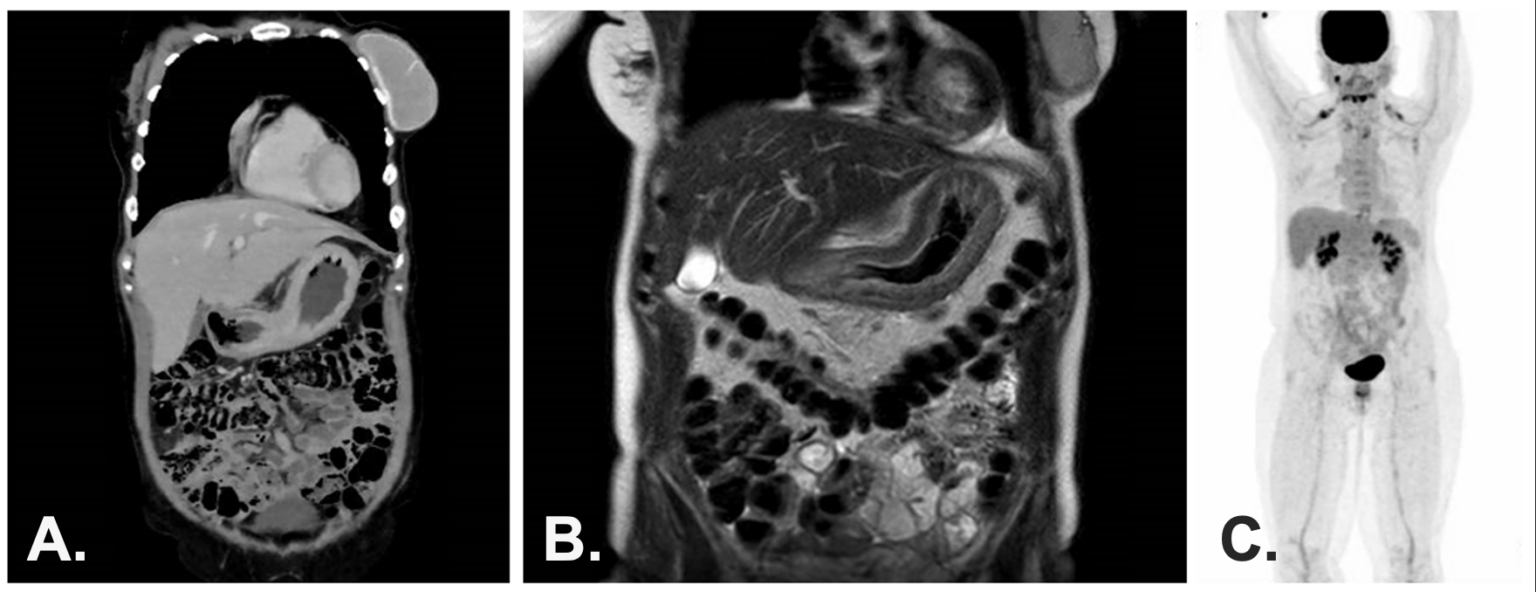 Sociedade Portuguesa de Gastrenterologia